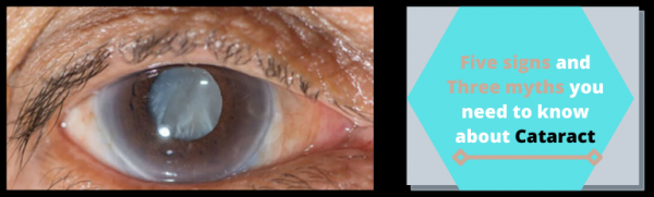 Here’s How Your Cataract Surgery Will Turn Out