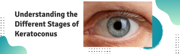 Causes Symptoms And Treatments Of Keratoconus