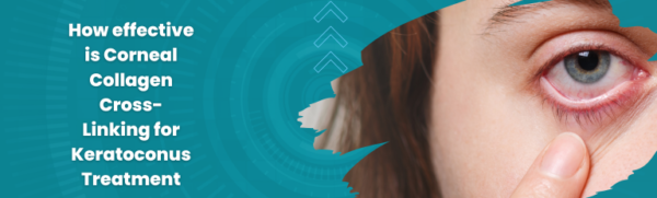 How Effective Is Corneal Collagen Cross-Linking For Keratoconus Treatment