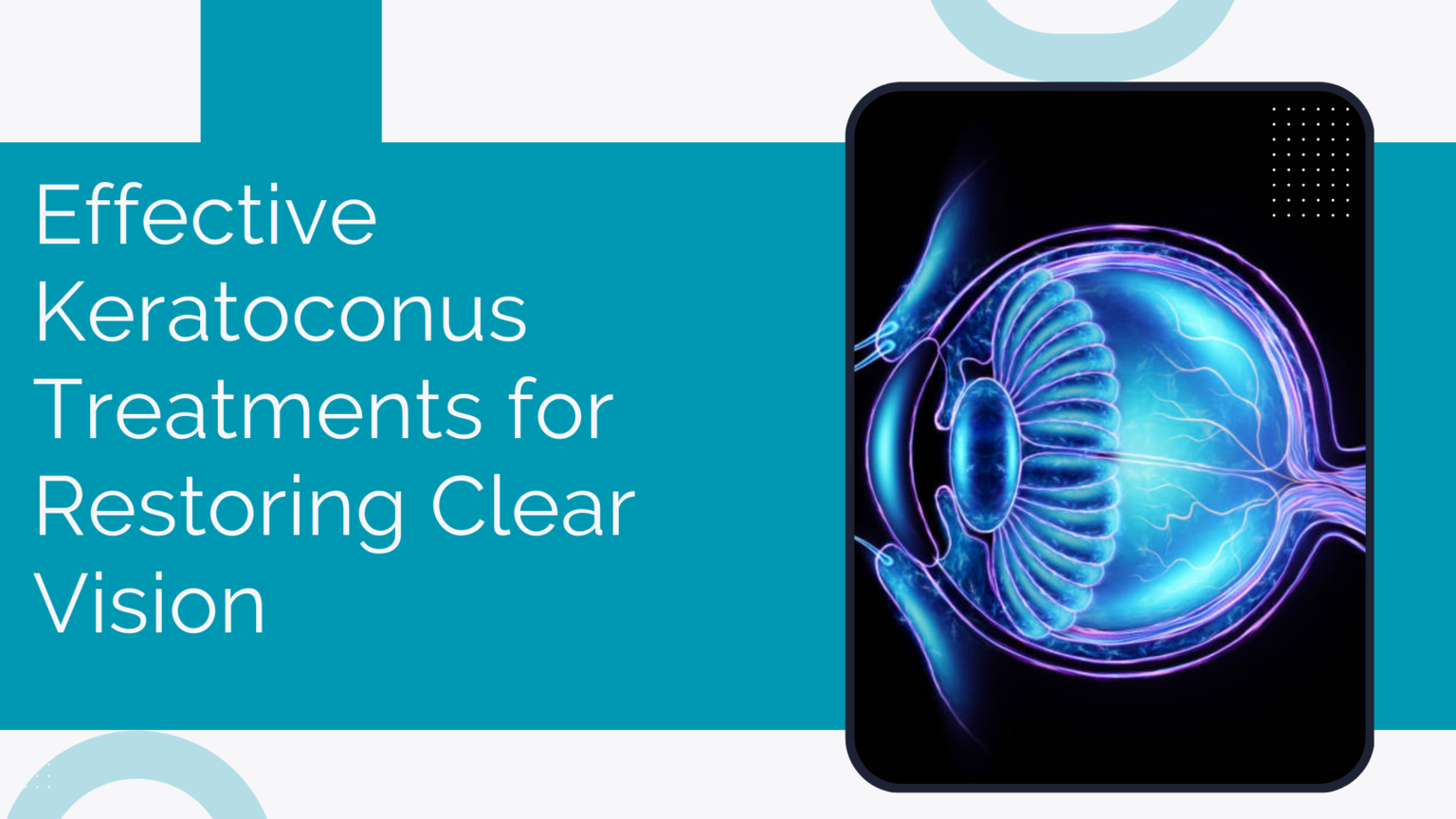 Effective Keratoconus Treatments For Restoring Clear Vision