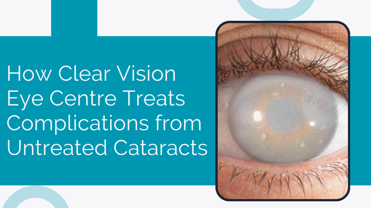 How Clear Vision Eye Centre Treats Complications from Untreated ...